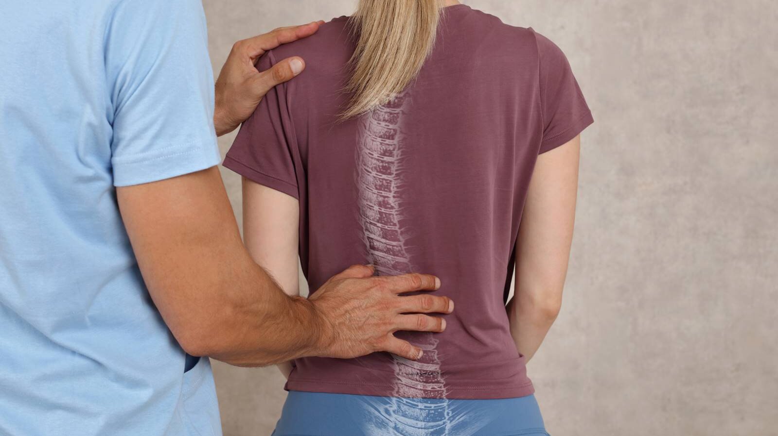 Skolioza: Koji su simptomi i kako se leči? - Zdravlje - Dnevni list Danas