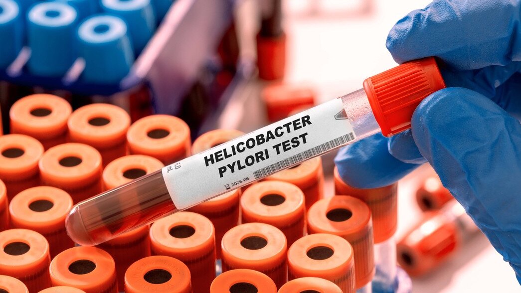 Heliko bakterija: Kako se prenosi i koji su simptomi - Život - Dnevni ...